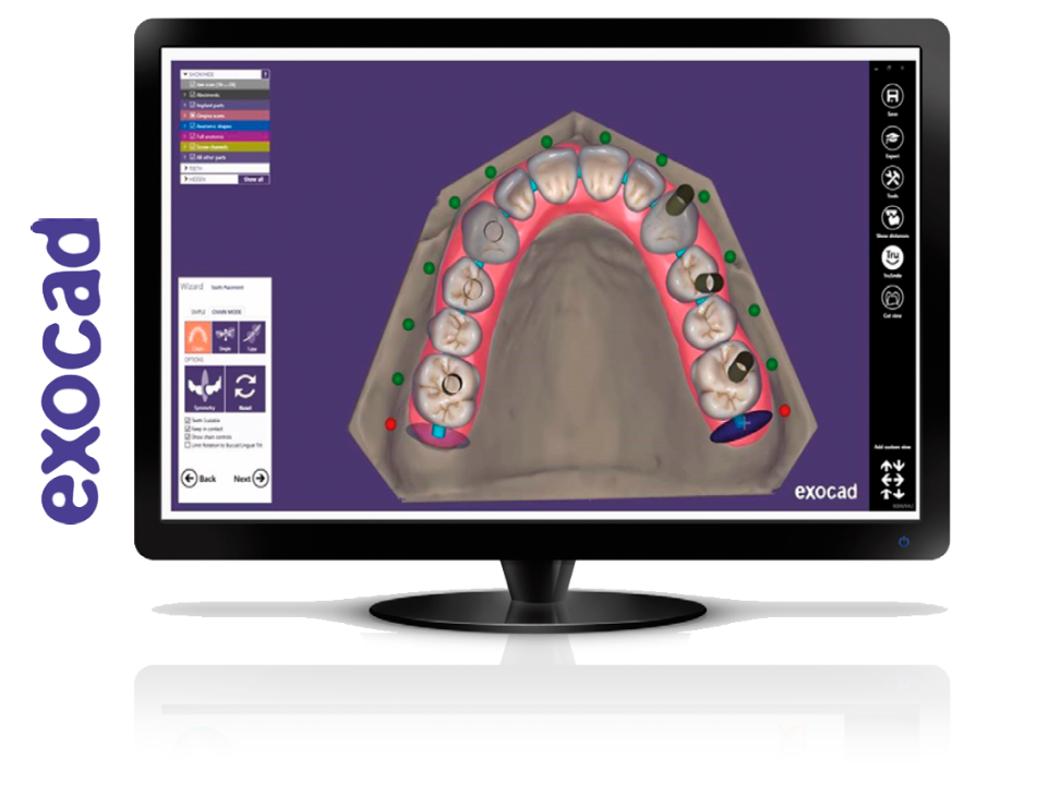 Librerías CADCAM | NetPlus Dental